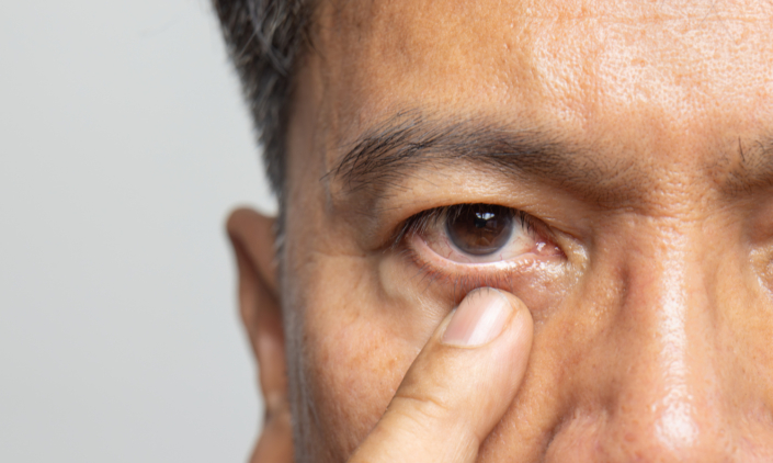 Cataracts vs. Glaucoma: Key Differences & Treatment Options