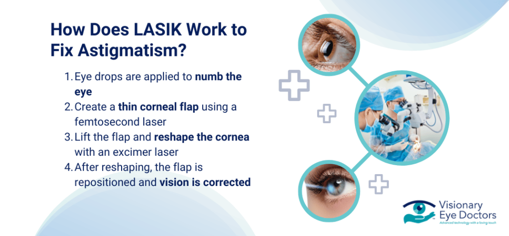 Can LASIK Fix Astigmatism?