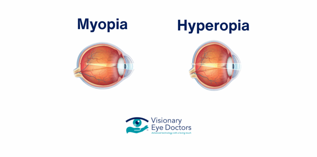 Nearsightedness vs Farsightedness: Symptoms, Causes & Treatment Options